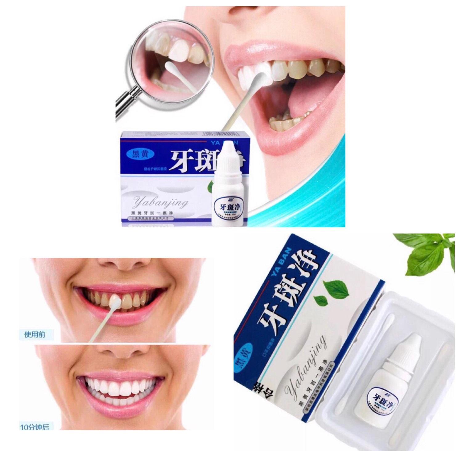 Healthy Teeth Whitening by Yabanjing | Lazada PH