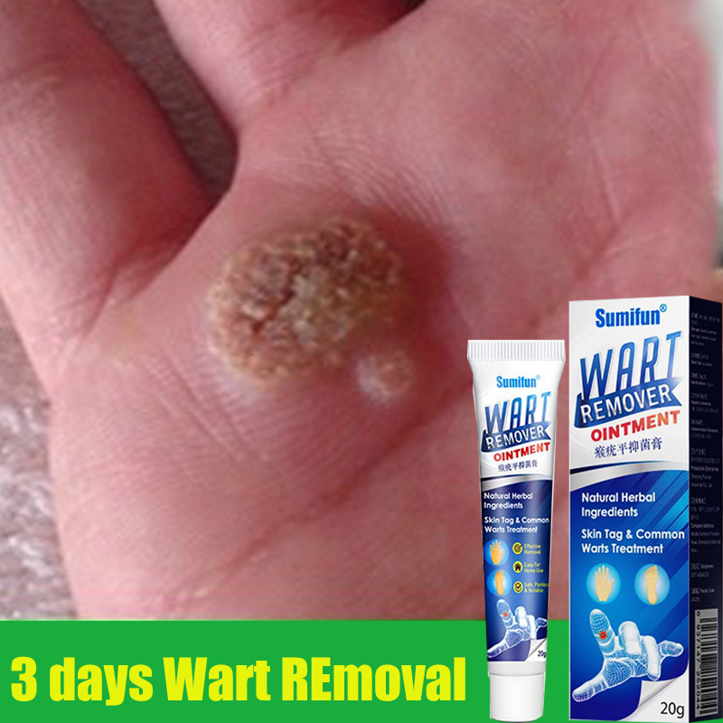 SUMIFUN Warts Remover Original Cream 20g 🔥Effective in 5 days🔥Warts ...