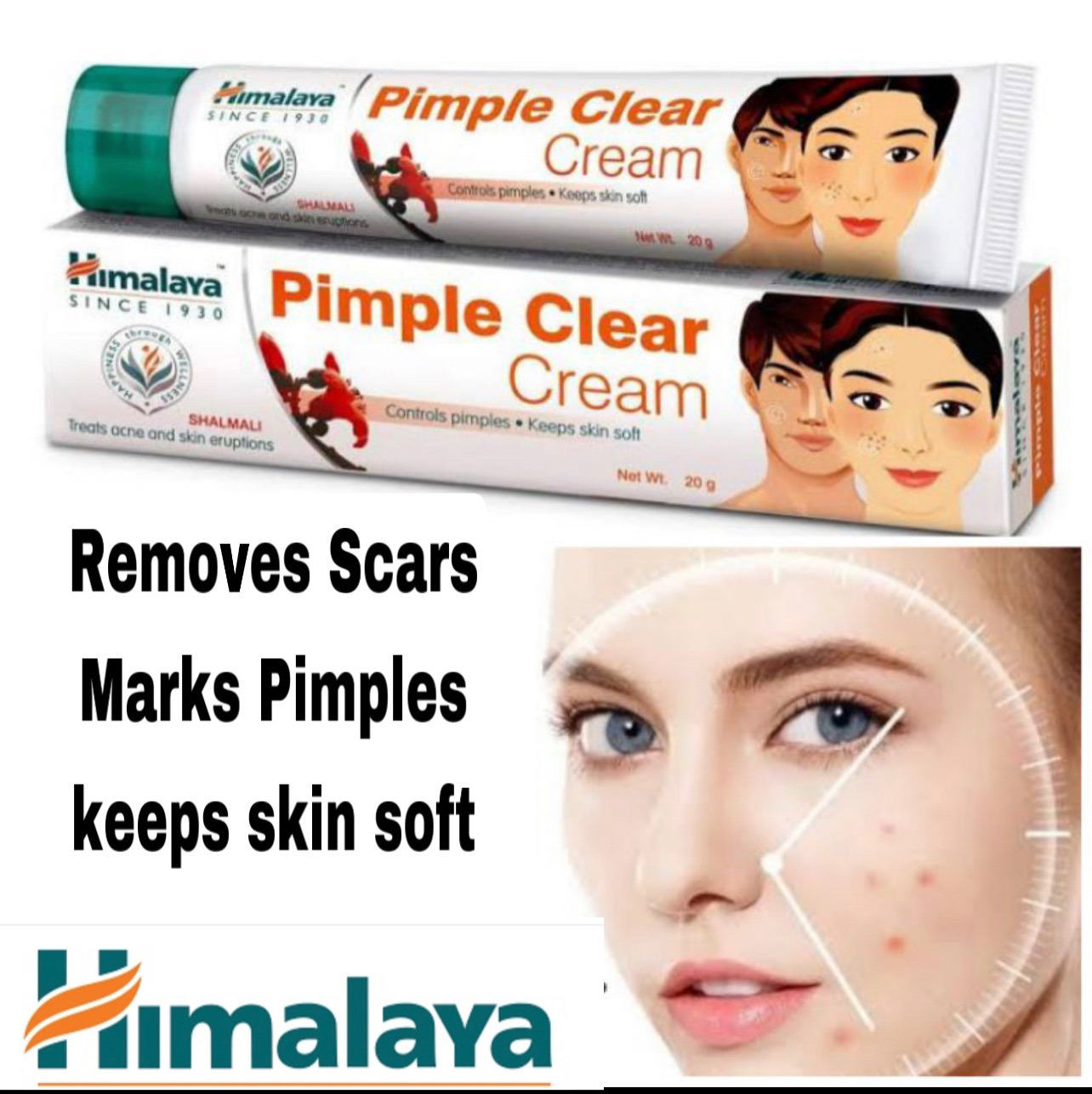 Himalaya Pimple Clear Cream Removes Scars Marks Pimples keeps Skin Soft ...