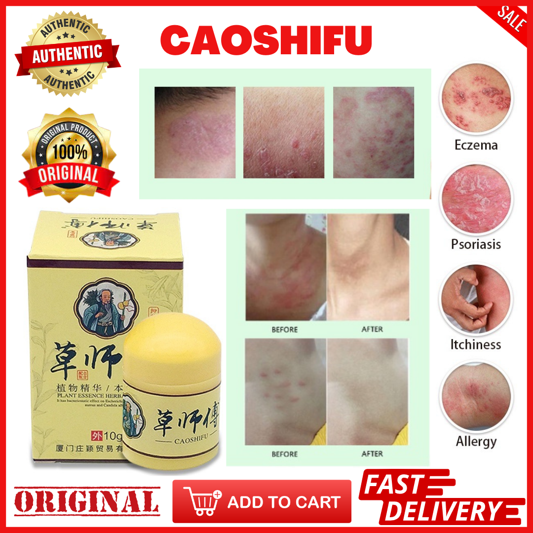 ️100%Organic Caoshifu Psoriasis Treatment Cream] Psoriasis Herbal ...