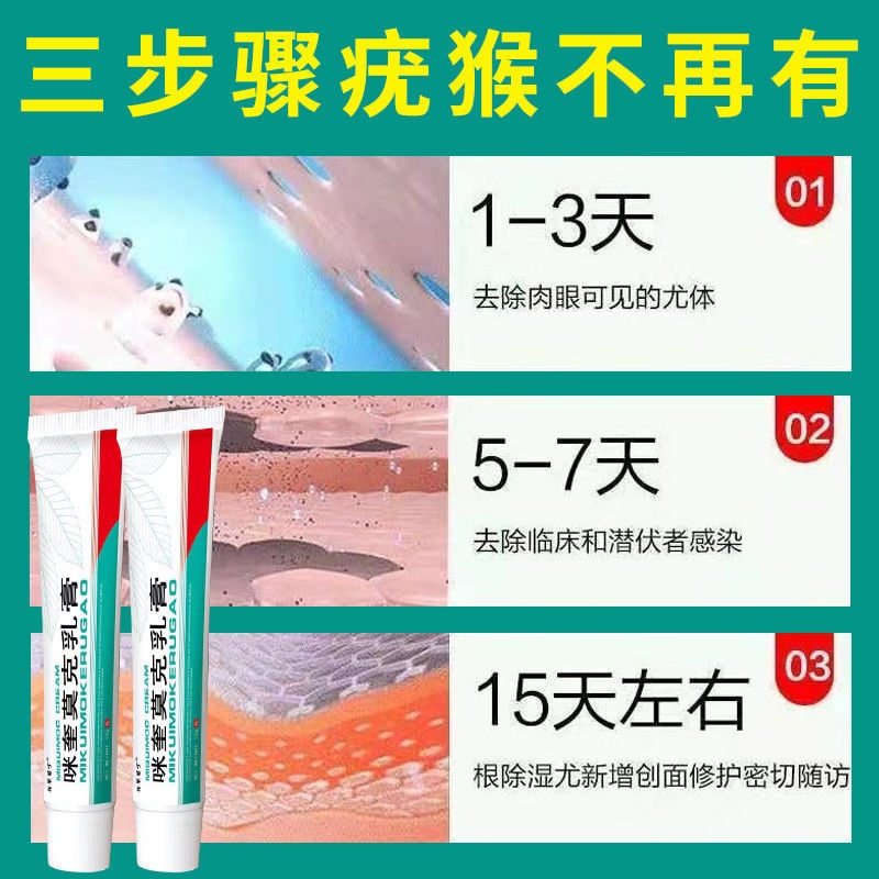 Genuine imiquimo cream 5 ointment neck to remove monkey meat pimple ...