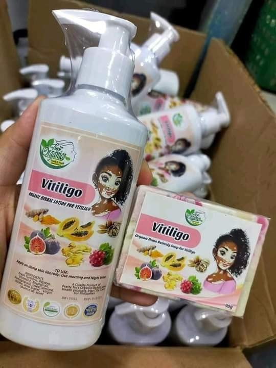 VITILIGO TREATMENT SOAP & LOTION | Lazada PH