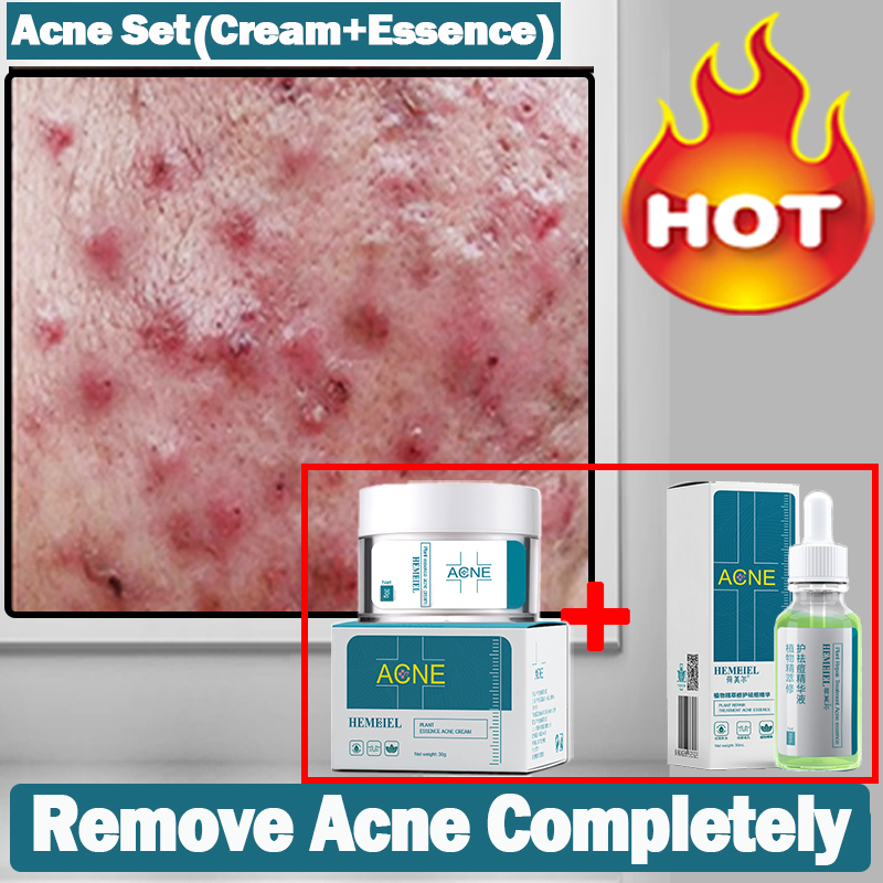 HEMEIEL Remove Pimples Serum Acne Serum Acne Face Seru Facial Pimple ...