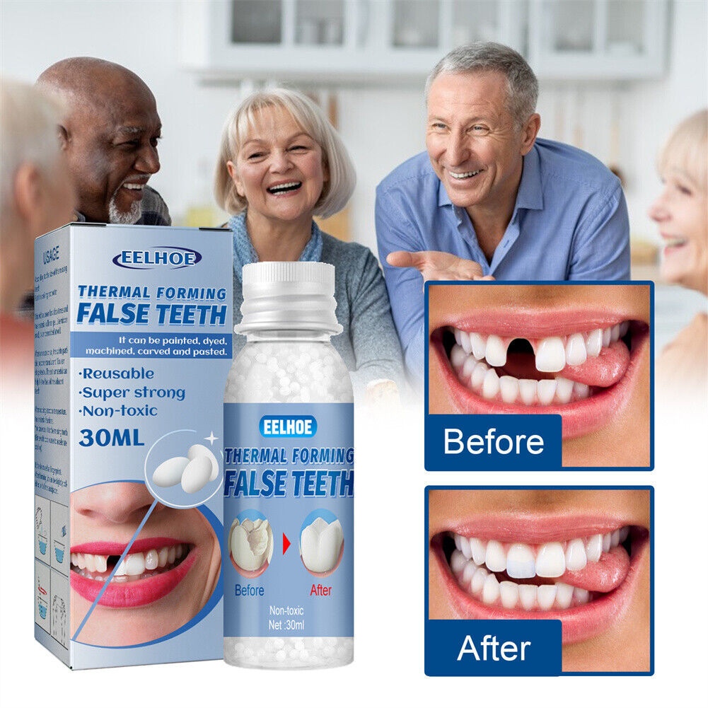 EELHOE Temporary Tooth Repair Kit Teeth And Gaps FalseTeeth Solid Glue ...
