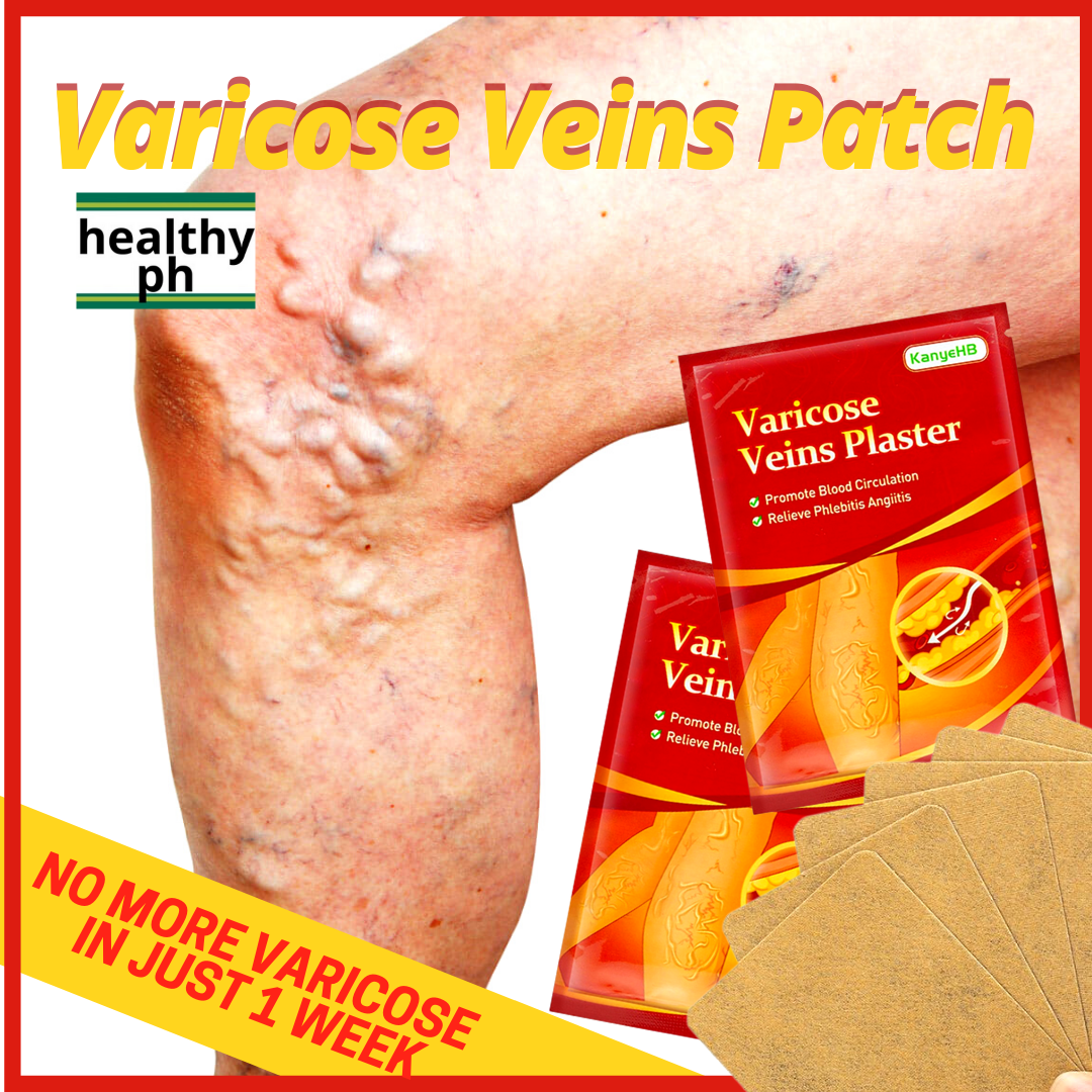 [ HEALTHY ITEMS ] VARICOSE VEINS PLASTER | Varicose Veins Pain Relief ...