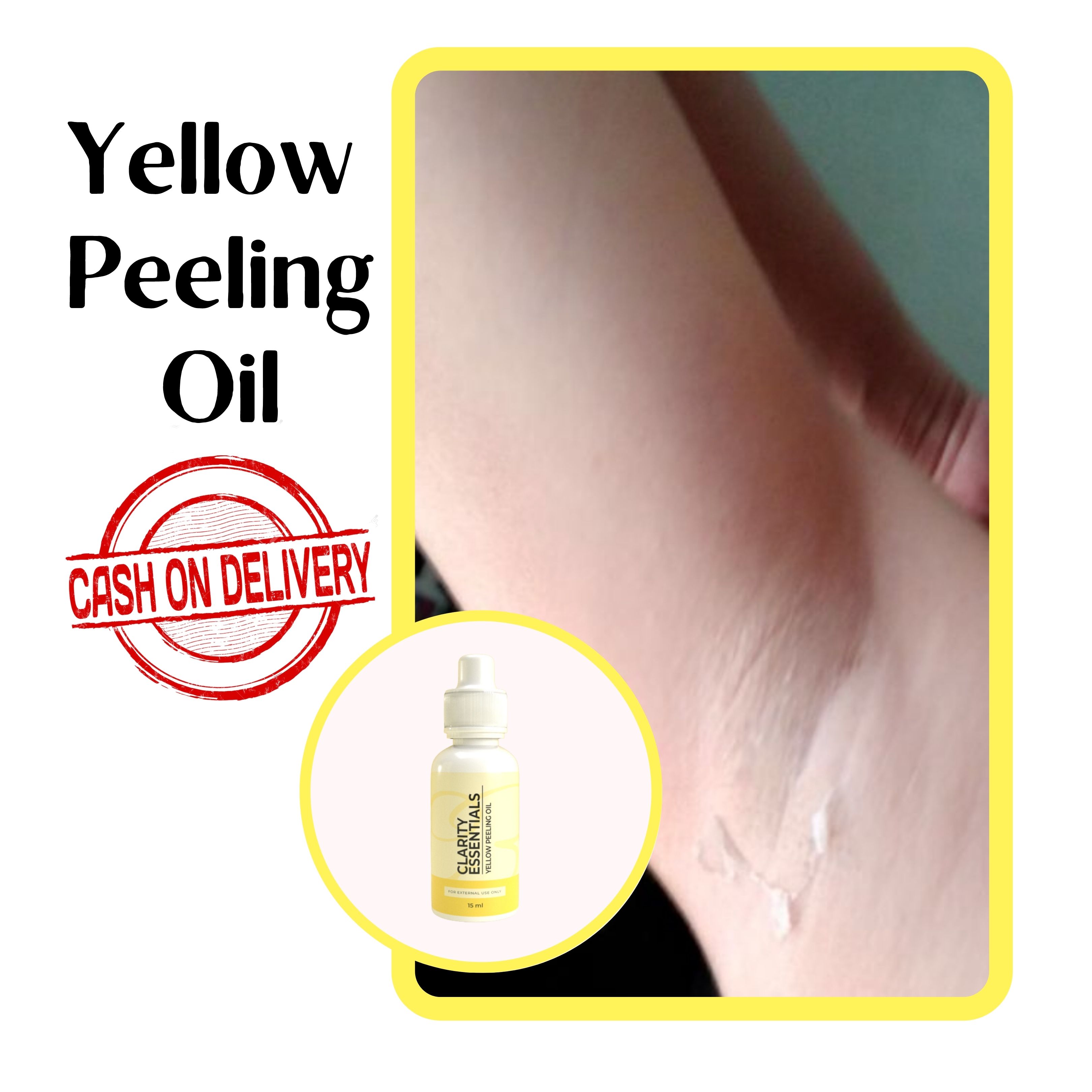 Yellow Peeling Oil 15ml - Skin Peeling - Body Peeling - Underarm ...