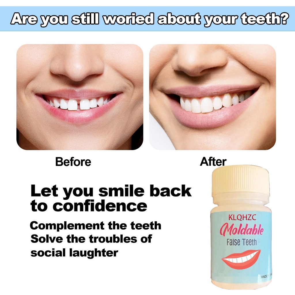 Temporary Tooth Repair kit 50g Artificial temporary tooth teeth Teeth ...