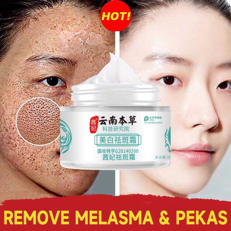 7days Whitening Orginal Japanese Melasma Cream Yunnan Herbal Whitening ...