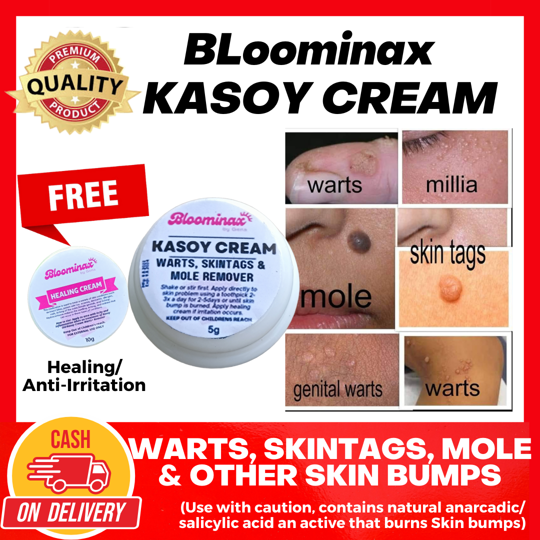 BLOOMINAX Warts Skintags Moles Remover 5g Kasoy Cream pantanggal ng ...