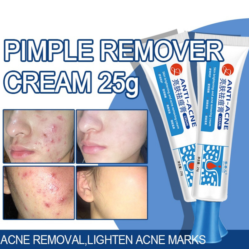 Acne Remover Cream Acne Scar Gel Pimple Marks Remover Cream Acne ...
