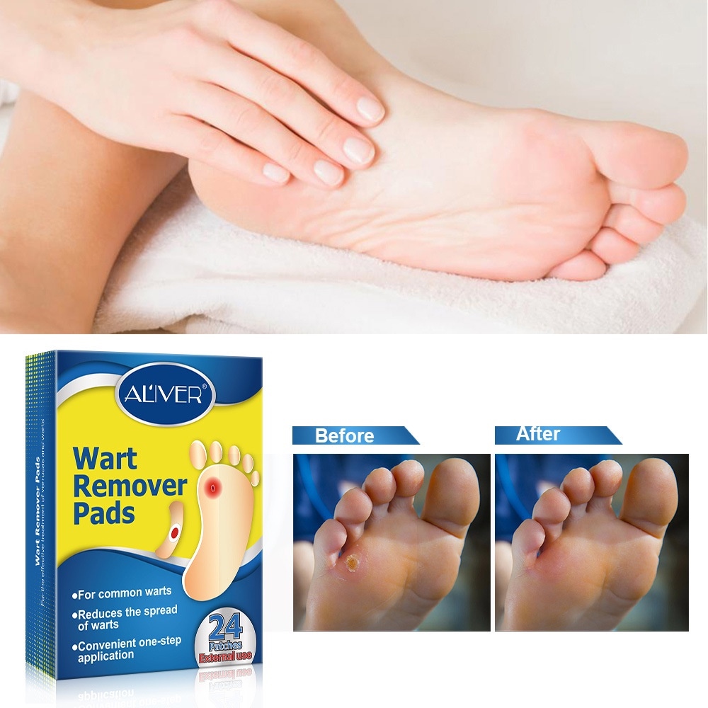 New 2023 24PCS Feet Corns/Warts Removal Patch Pain Relief Remover Warts ...