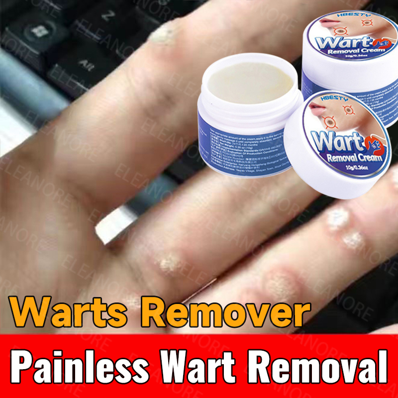 Wart removal original cream Painless Removal Wart warts removal ...