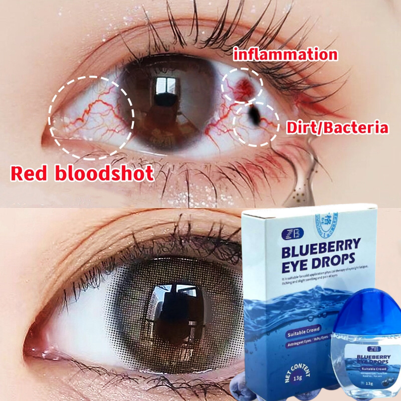 Original Blueberries Eye Drops for Clear Vision Dry Eyes Congestion ...