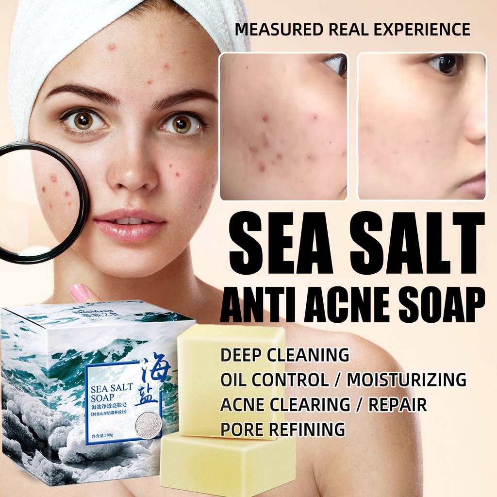 Sea Salt Soap Cleaner Removal Pimple Pores Acne Treatment Cleaner ...