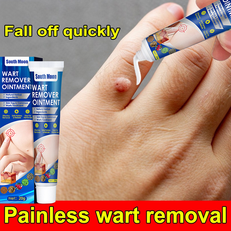 💖Safe Painless💖Wart Removal Ointment 20g Wart Remover Cream Wart ...