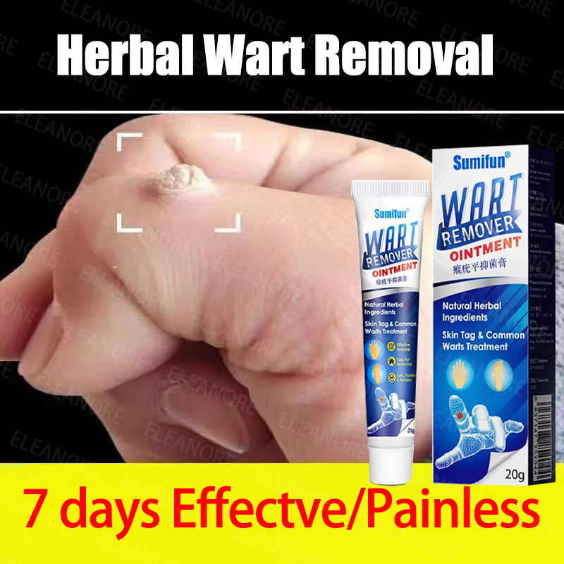 👍professional treatment👍 Warts Remover Original Cream Warts Magic ...