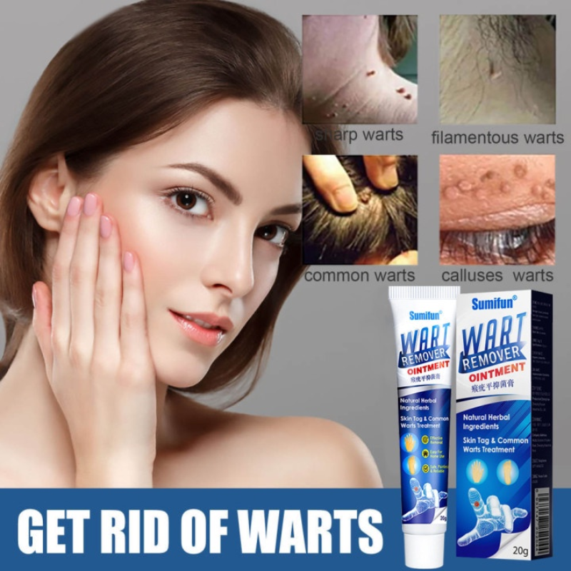 Sumifun Wart Remover Ointment Wart Treatment Cream Skin Tag Remover ...
