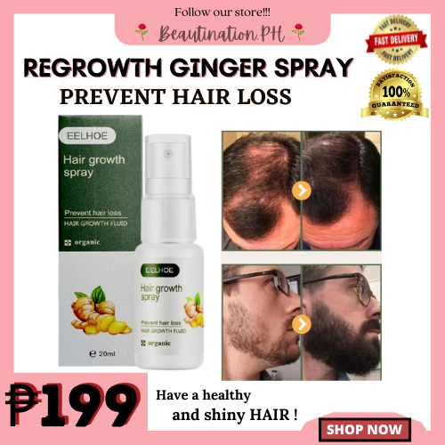 NEW ARRIVAL Regrowth Ginger Spray Fast Hair Growth Fluid Anti Loss ...