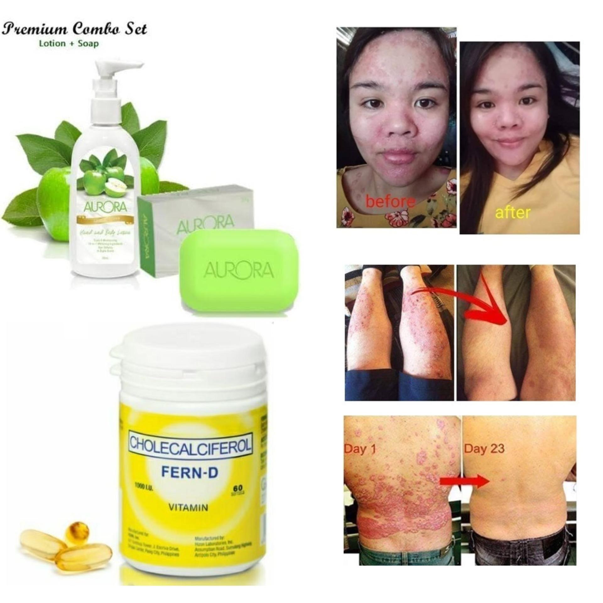 Fern D 60's 1000 I.U. softgels + Aurora Soap 135g + Aurora Lotion 200ml ...