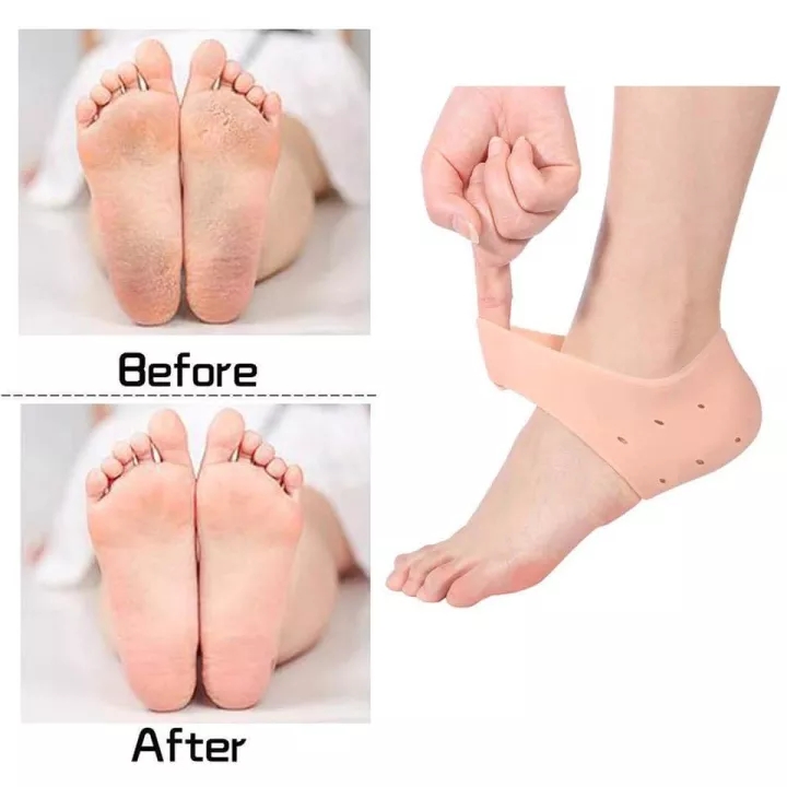 1pair Silicone Heel Socks Gel Footing Care Pad With Hole Feet Cracked Skin Moisturizing Foot ...