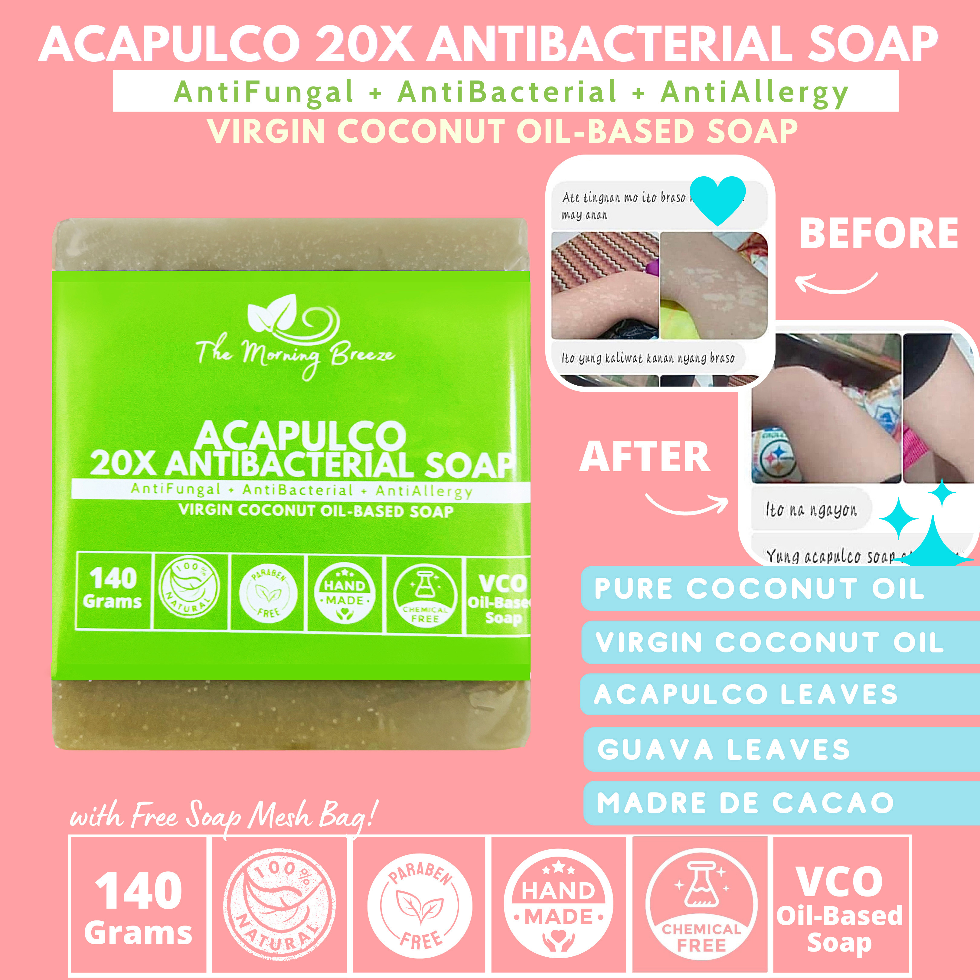 ACAPULCO 20X ANTIBACTERIAL SOAP AntiAcne, AntiFungal, AntiBacterial ...