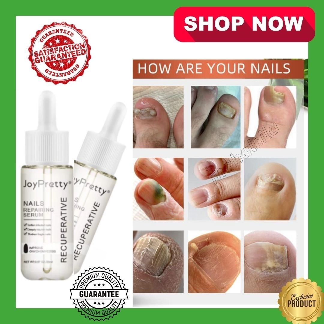 Joy Pretty | Nail Repairing Serum 20g | Grows Fingernails And Foot ...