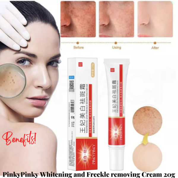 Whitening and Freckle removing Cream 20g Effective Freckle Cream Remove Dark Spots PinkyPinky ...