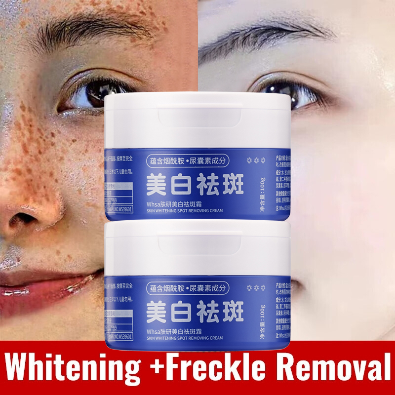Japanese Melasma Cream Whitening Freckle Cream Japanese Melasma Cream ...
