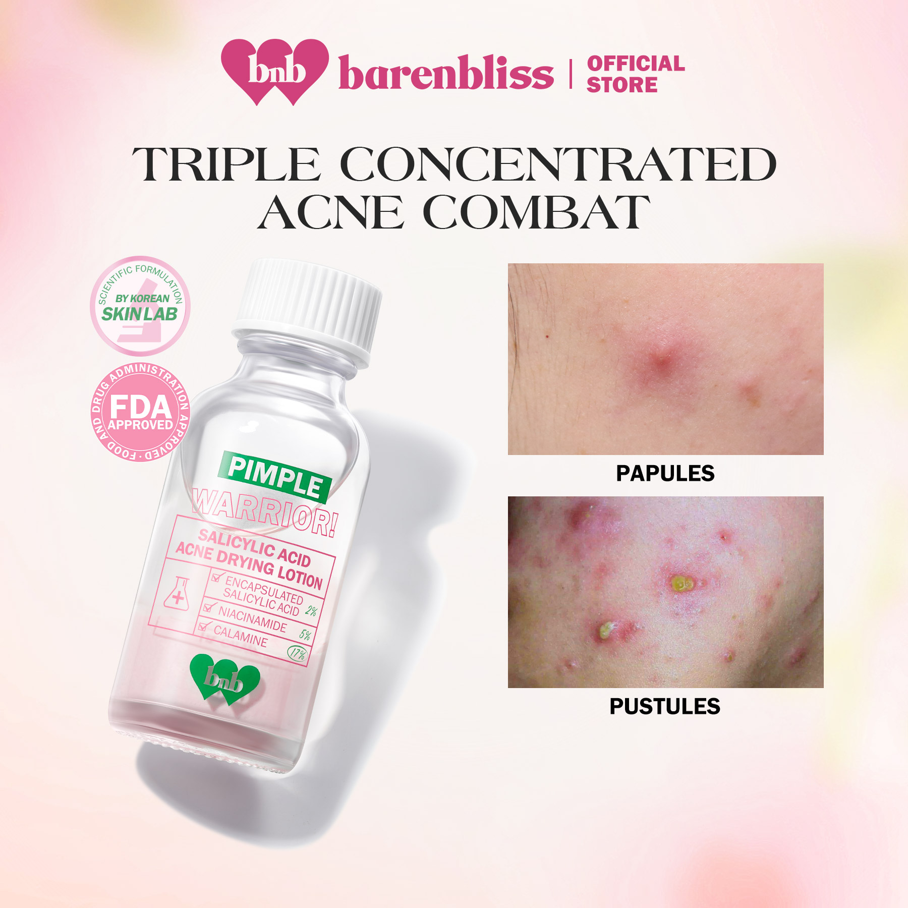 【BEST SELLER】 barenbliss BNB Pimple Warrior! Salicylic Acid Acne Drying ...