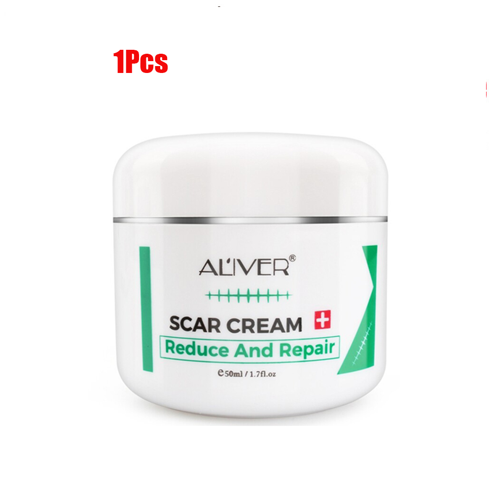 【100% Effective】Original Aliver Peklat Remover Cream for Old Peklat ...