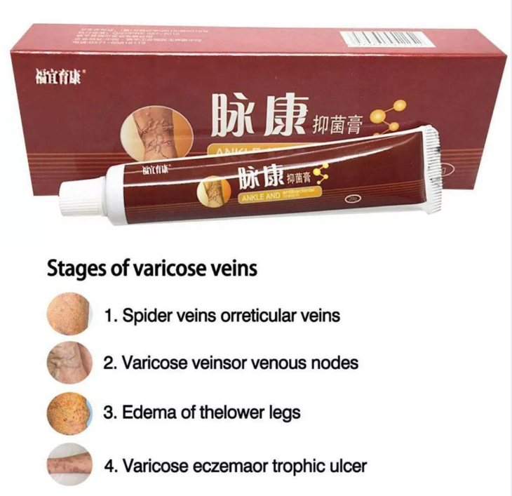 🔥 [MEGASALE PULSE KANG] Varicose Veins Treatment Cream Ointment Health ...