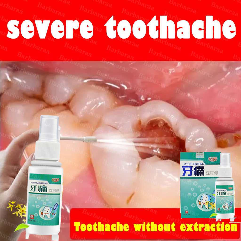 Safe to eat 35ml Toothache Spray35ml Toothache quick pain relief spray ...