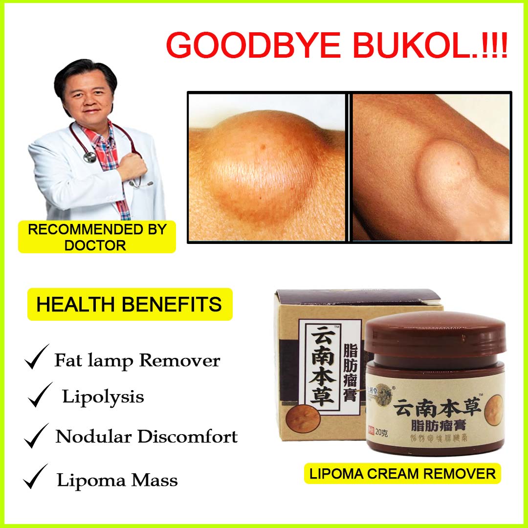 Lipoma Removal Cream Treat Tumor Skin Swelling Herbal Ointment made in ...