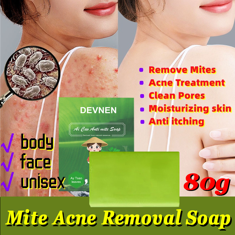 DEVNEN Antibacterial Soap Natural Plant Essence Soap for Anti-Itchy ...