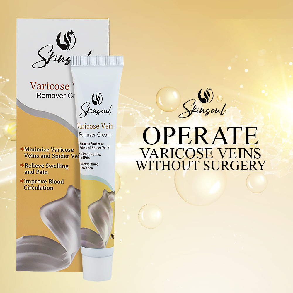 Skinsoul Varicose Vein Remover - Treatment Cream Spider Vein Pain ...