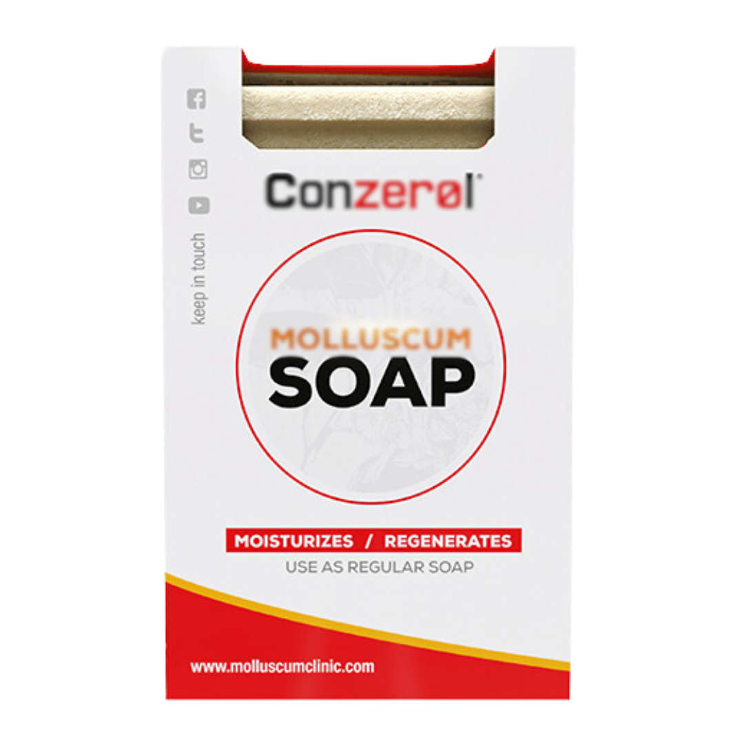 Conzerol Stop Molluscum Soap | Lazada PH