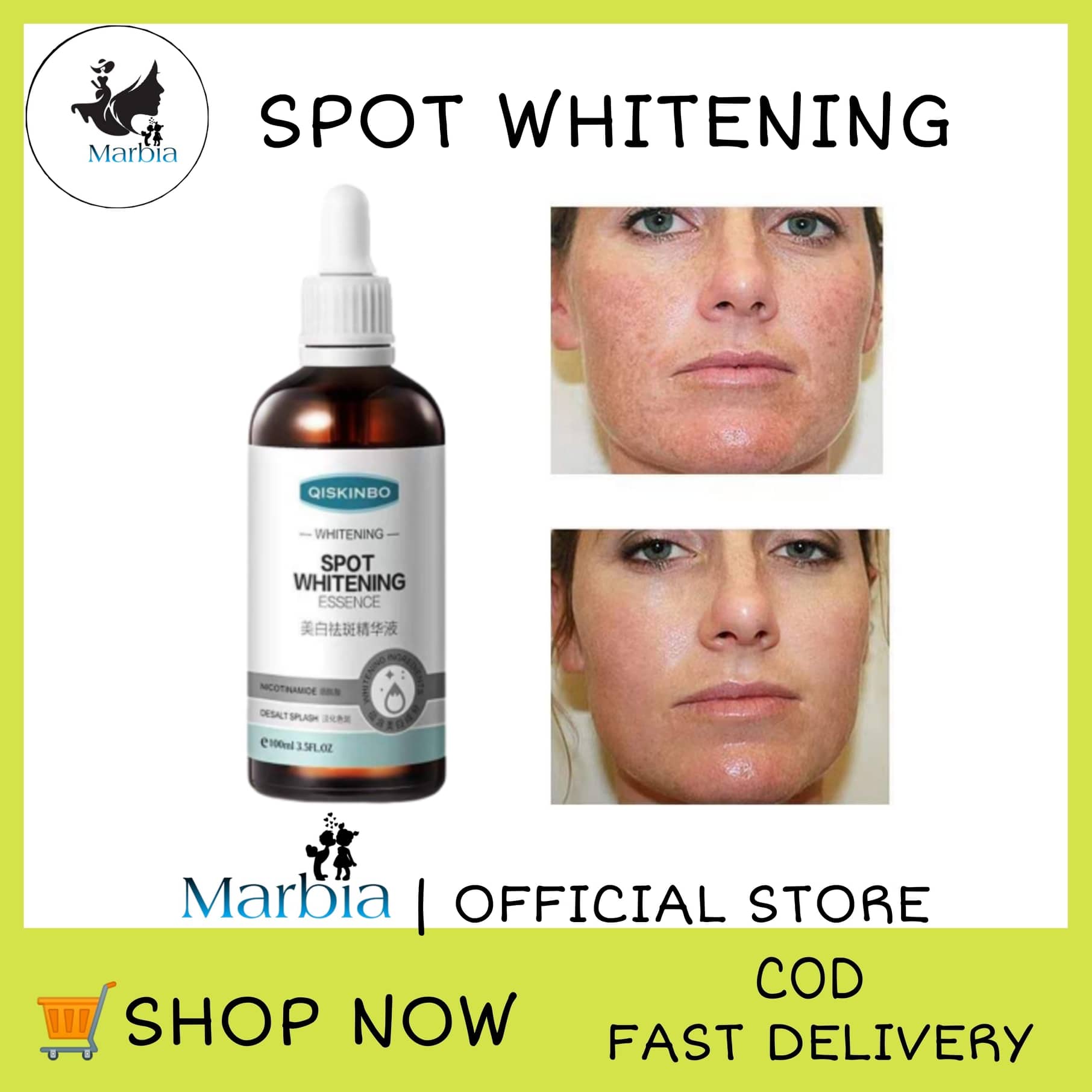 BEST SELLER ORIGINAL Qiskinbo Spot Whitening Essence Serum Anti ...