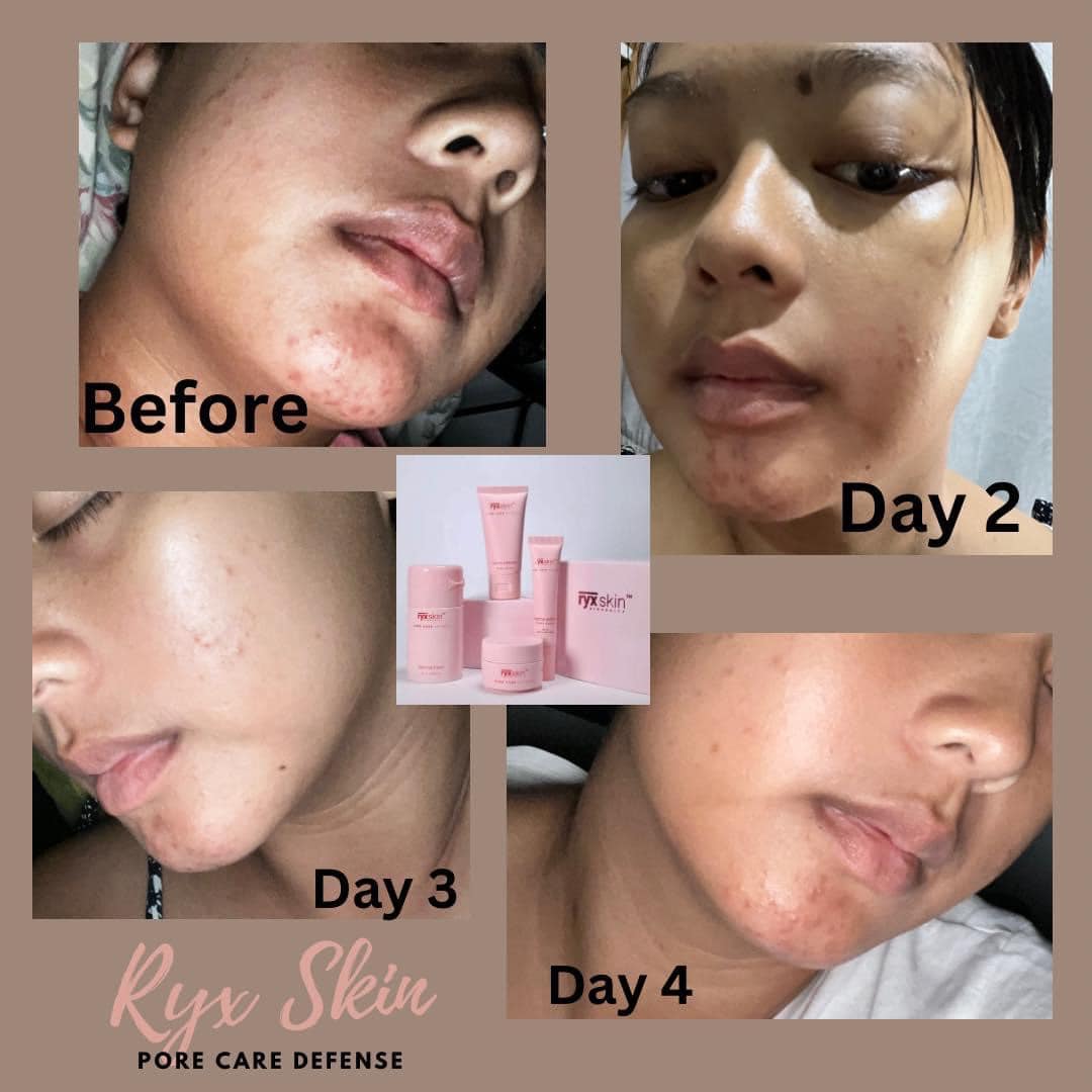 Pore care Authentic with FREEBIE RYX PORELESS MAINTENANCE SET NEW ...