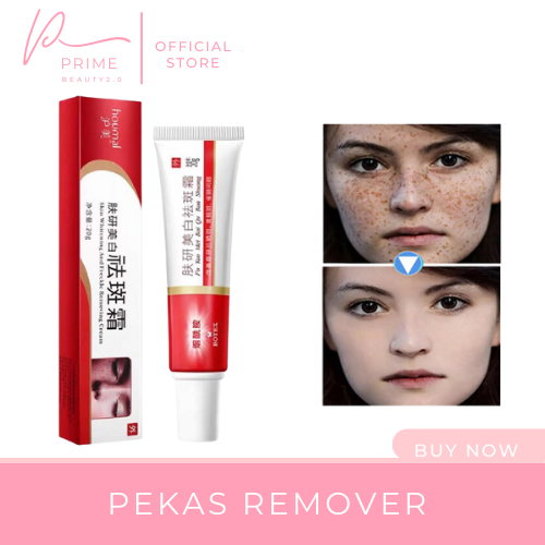 PEKAS REMOVER Effective Whitening & Freckle Remover Cream | Melasma ...