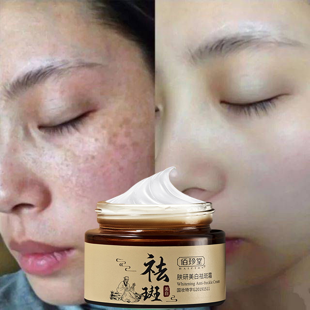 Melasma Cream Original collagen melasma remover Melasma And Pekas ...