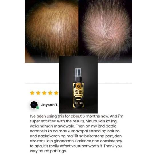 Pablings Balbas Sarado 5 PREMIUM MINOXIDIL Beard and Hair Growth ...