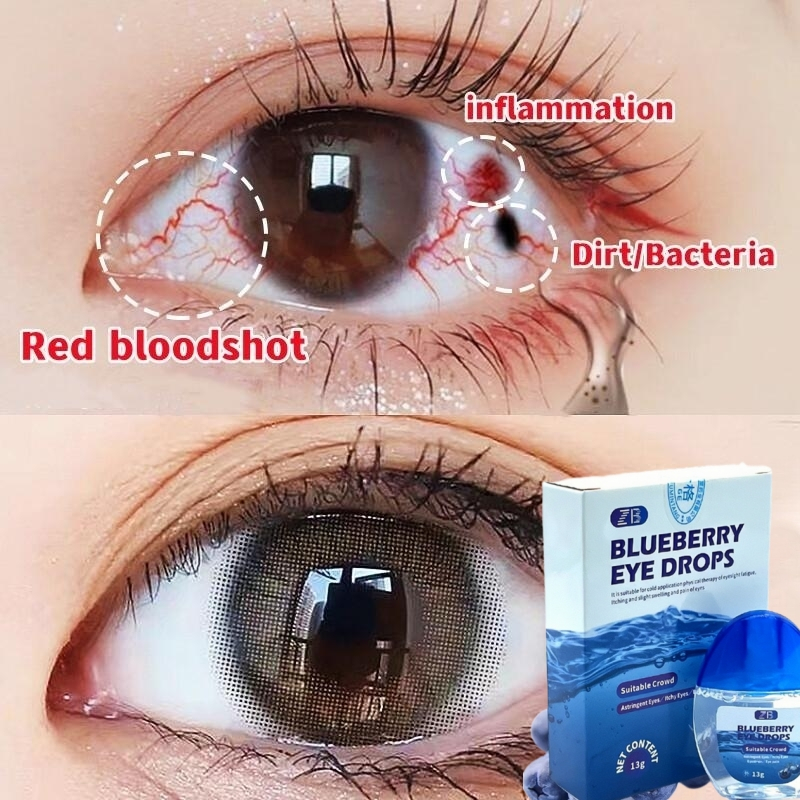 Eye Drops Dry Eye Anti-Fatigue Eye Congestion Blurred Eyes Redness Eyes ...