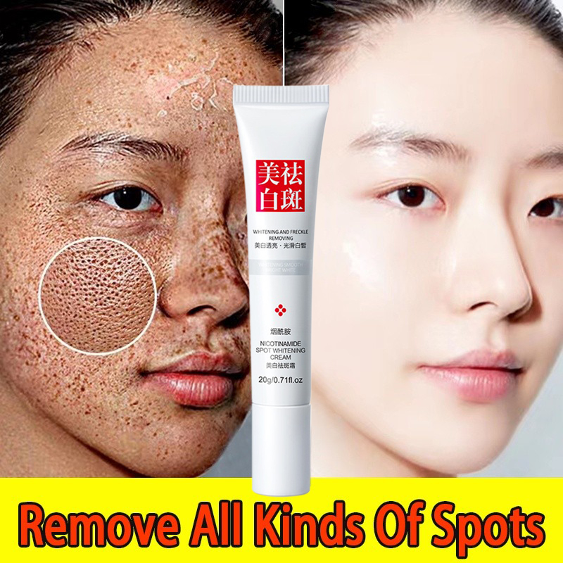 Original Strong Anti Freckle Whitening Cream Powerful Removing Age Dark ...