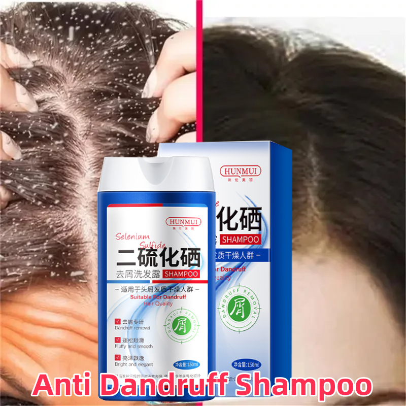 Selenium Disulfide anti-dandruff and anti-itch Shampoo Refreshing oil ...