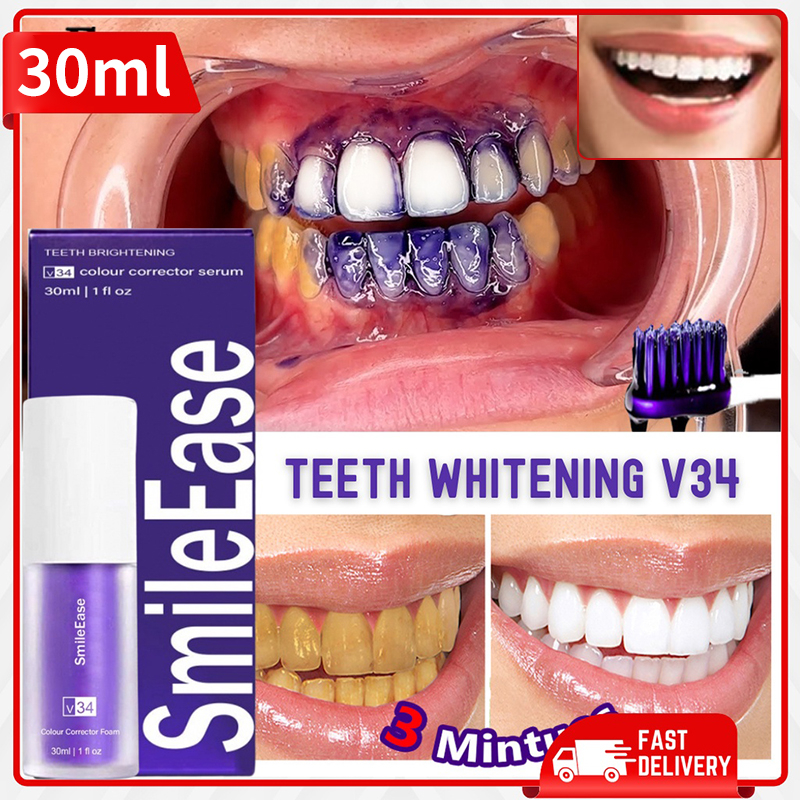 Teeth Whitening Toothpaste 30ml V34 Colour Corrector Serum Remove Stain ...