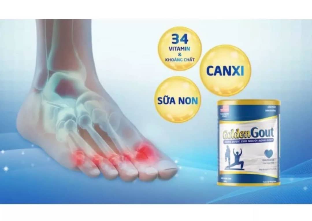 Authentic GOLDEN GOUT COLOSTRUM MILK 400G | FIRST GOUT TREATMENT ...