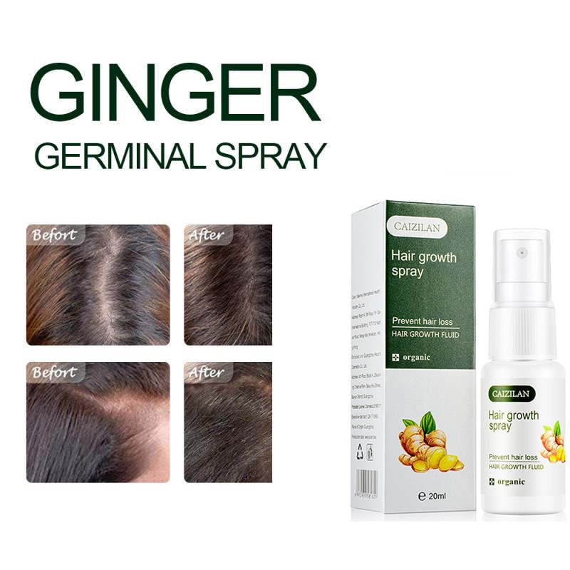 Regrowth Ginger Spray Fast Hair Growth Fluid Anti Loss Treatment Ginger ...