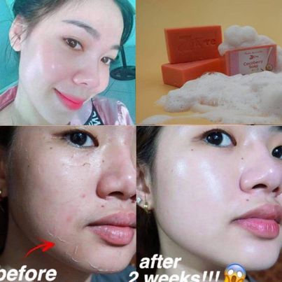 SET OF 2 TRENDING NA SABON NA PAMPAKINIS AT PAMPAPUTI IN JUST 1-2 WEEKS LANG!ZAFYRE COCOBERRY ...