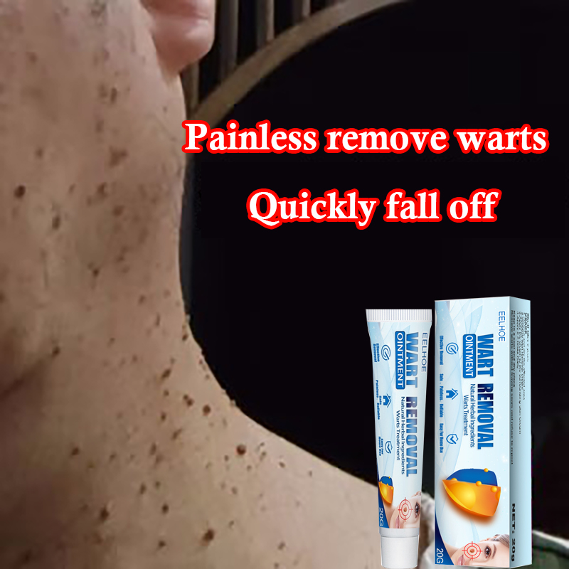 Original wart remover neck wart remover Skin label Underarm flat wart ...