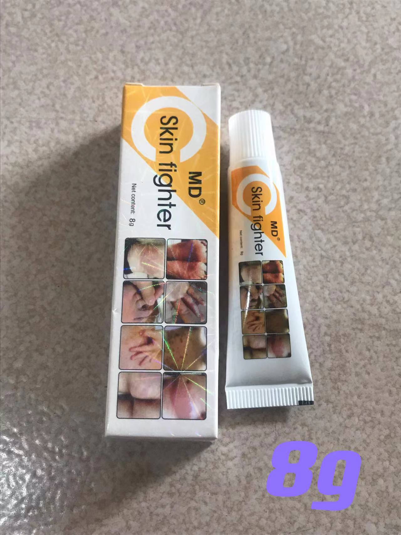 Skin fighter Cream for Allergies Fungis Itching Redness Rashes 15g/35g ...